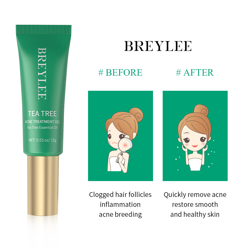 BREYLEE Acne Treatment Gel - Effectively Treat Acne & Pimple