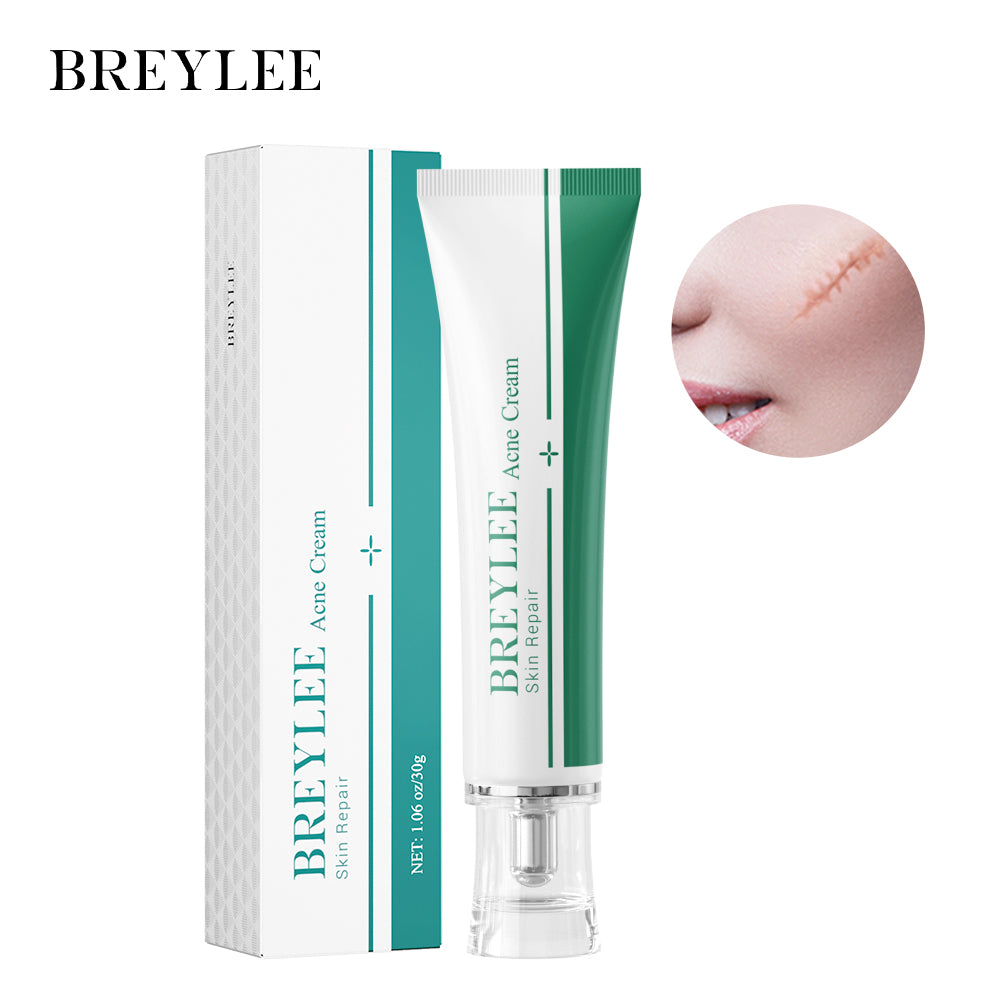 BREYLEE Acne Scar Removal Cream - Treating Scars