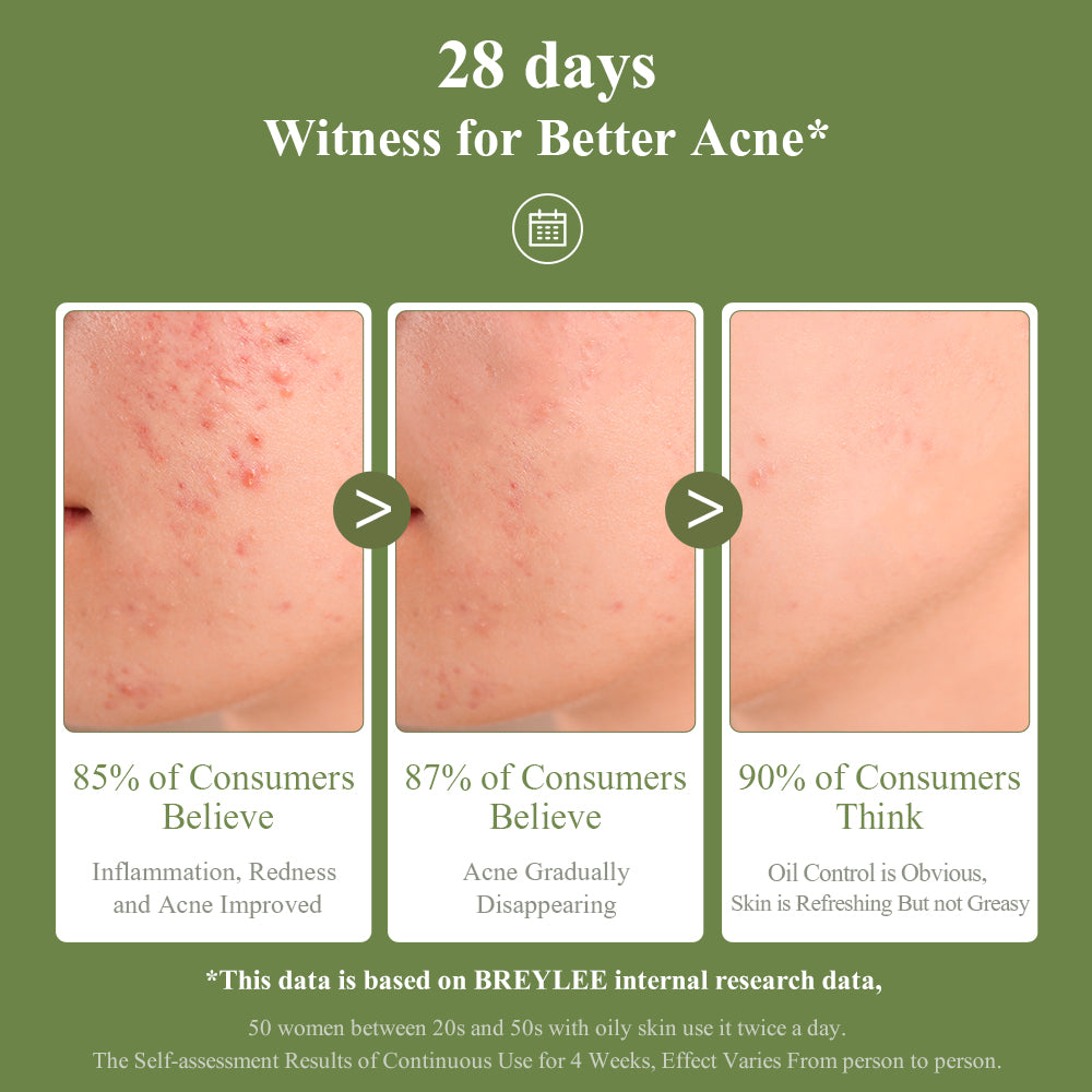 BREYLEE Acne Treatment Gel - Effectively Treat Acne & Pimple