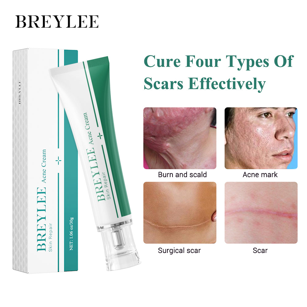 BREYLEE Acne Scar Removal Cream - Treating Scars